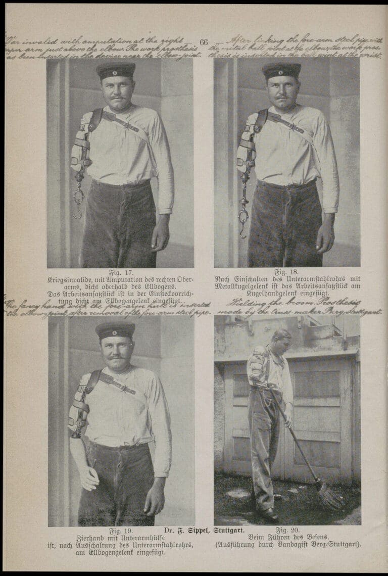 Disabilities in Society, Seventeenth to Twentieth Century
